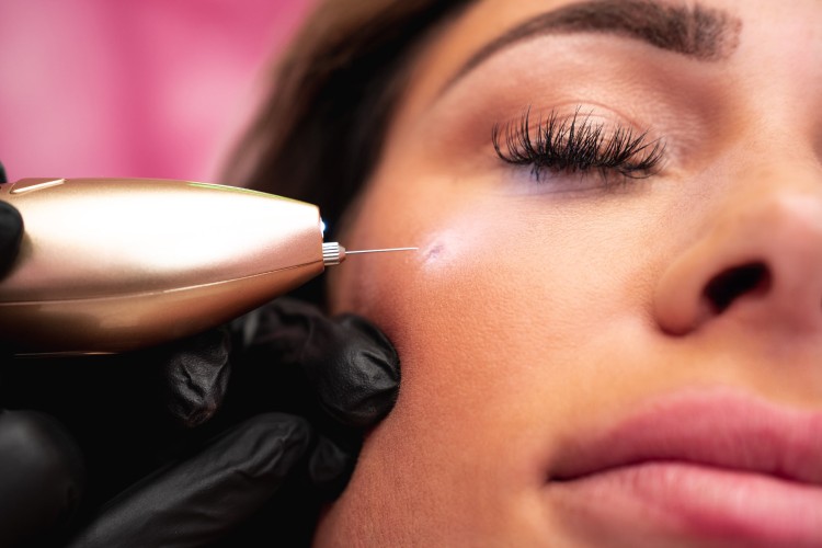 Skin bumps removal | FillerHouse